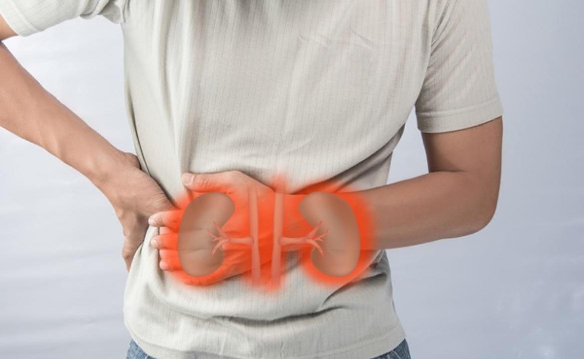 Piatra de la rinichi poate fi eliminată fără operație. Intervenția nu ...