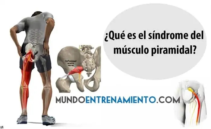 Întindere piramidală, mușchiul uitat - ea.md